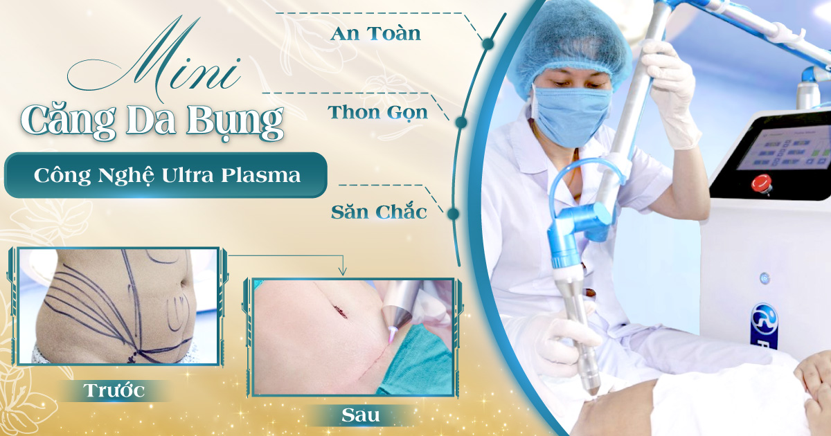 Căng da mini căng da bụng công nghệ Ultra Plasma tại Yeosin