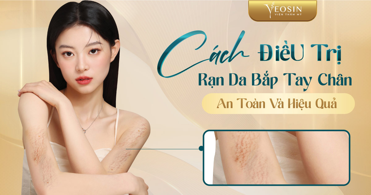 Rạn da chân tay - Cách trị rạn da bắp chân bắp tay hiệu quả